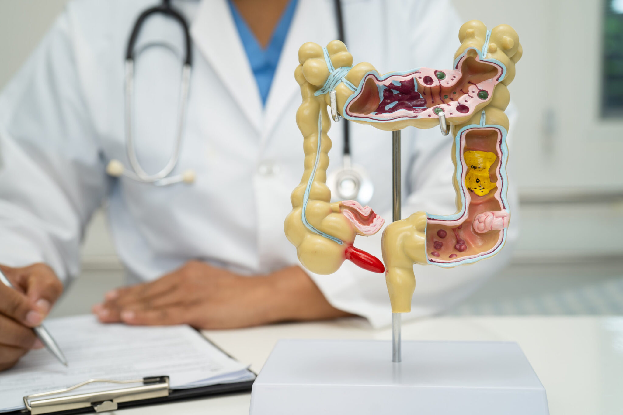 What Are Spore-Based Probiotics? – Dr Guberman
